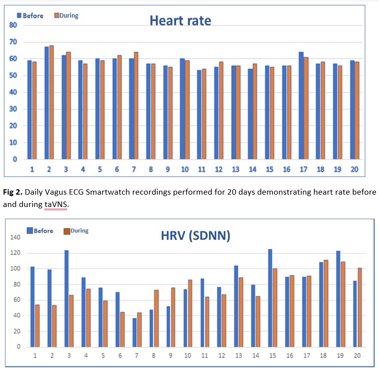 Case Study - Findings about the VAGUS test - BREATHE FLOW - Free health ...